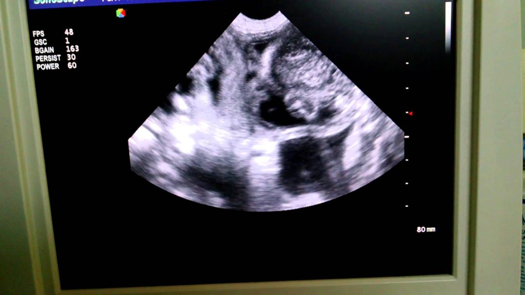 German Shepherd Pregnancy Week By Week - Symptoms, Calendar And Stages